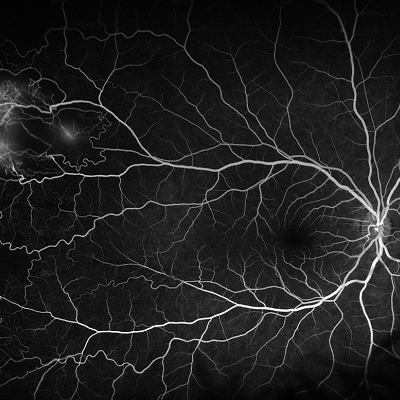 Home - The American Society of Retina Specialists